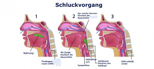 Heimlich-Handgriff >> Maßnahme bei Erstickungsgefahr