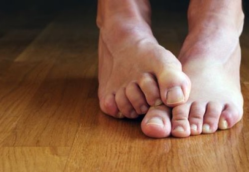 Plantarfasziitis: Was ist das und was hilft dagegen? - Besser Gesund Leben
