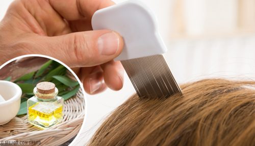 Was sind Filzläuse und wie werden sie übertragen - Besser Gesund Leben