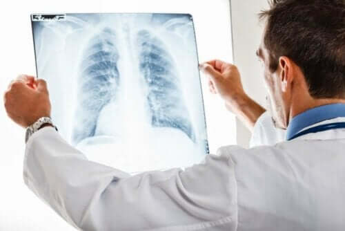 Wie ansteckend ist Bronchitis? - Besser Gesund Leben